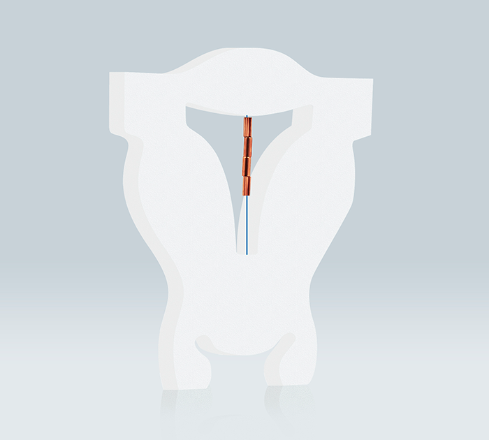 GyneFIX® Training und Fachbereich