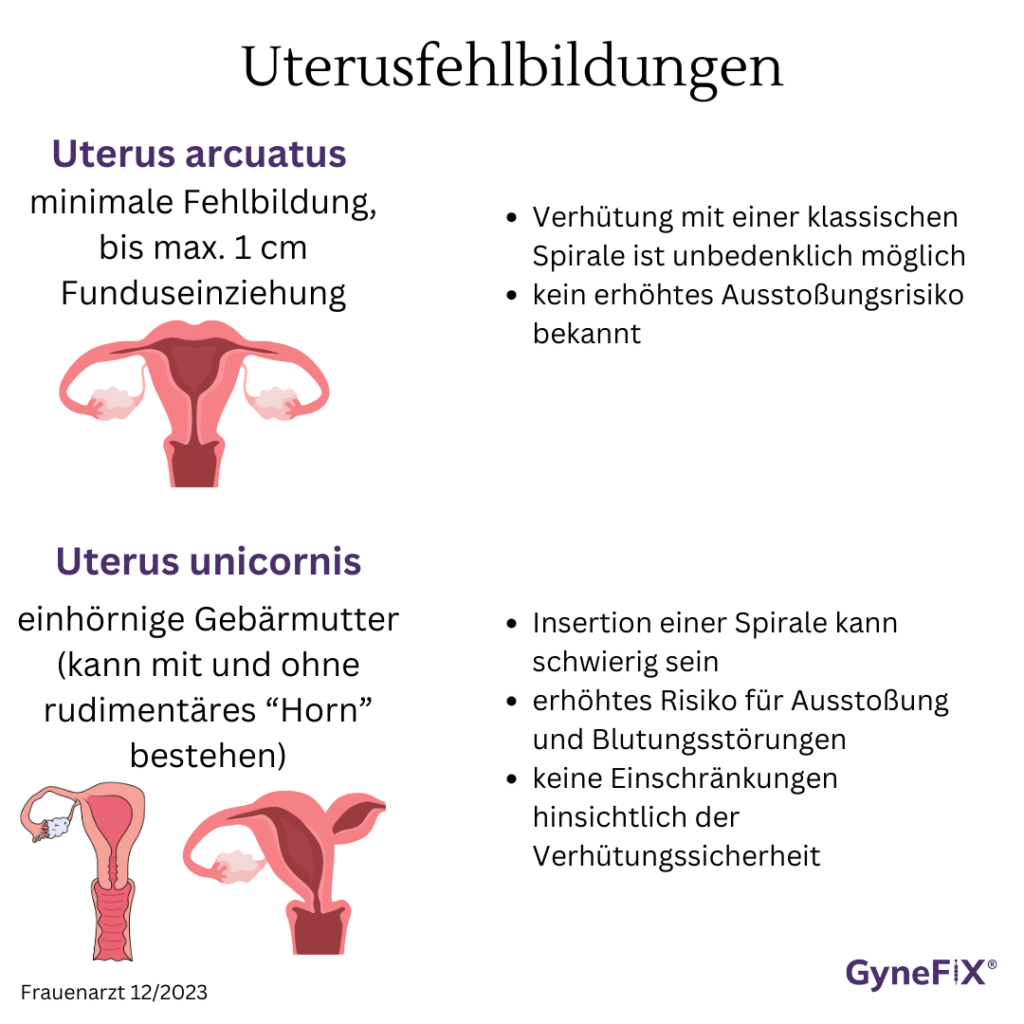 Verhütung bei Uterusfehlbildung