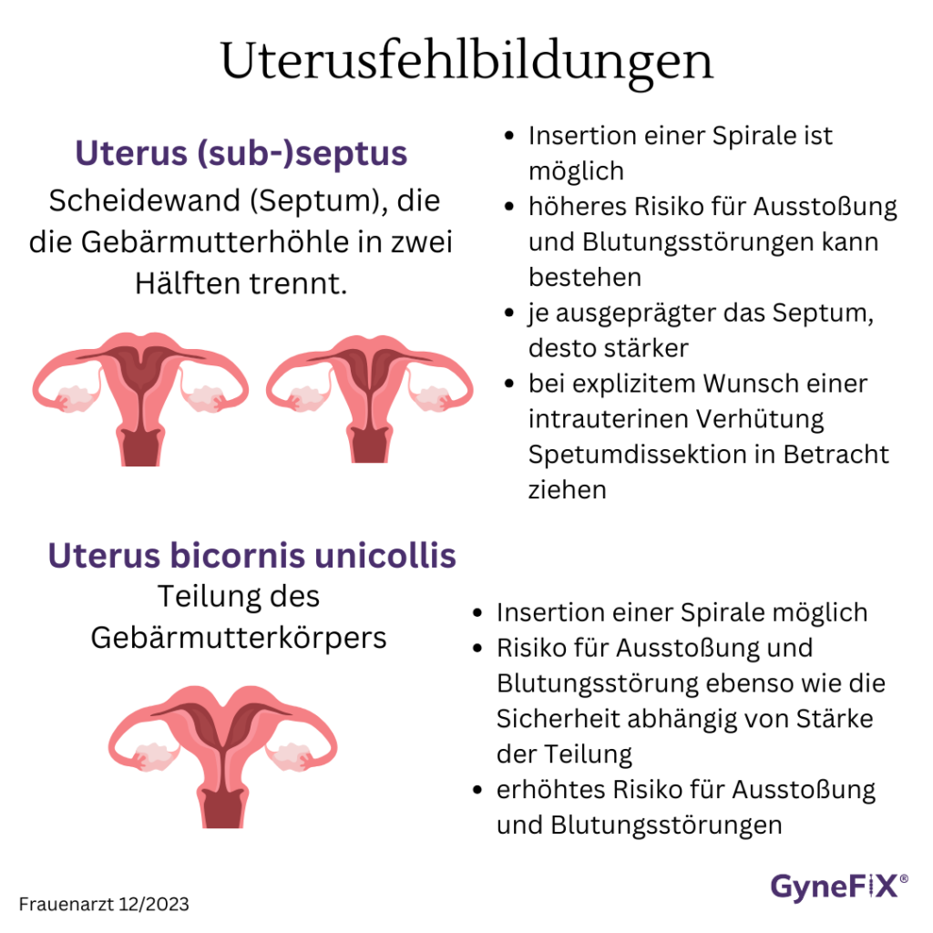 Verhütung bei Uterusfehlbildung