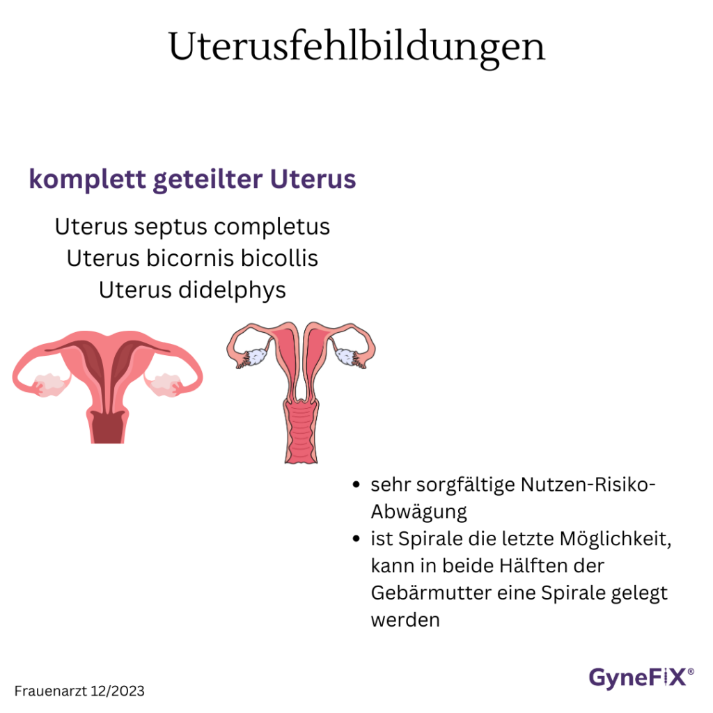 Verhütung bei Uterusfehlbildung
